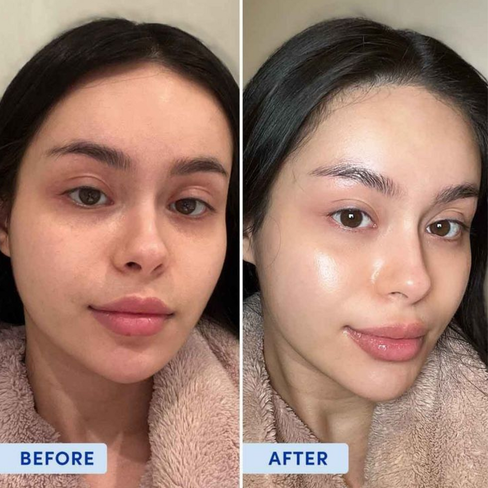 Glycolic Acid 7% Toning Solution – KLEO